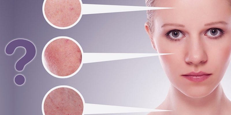How To determine Your Skin Type in Five Easy Methods